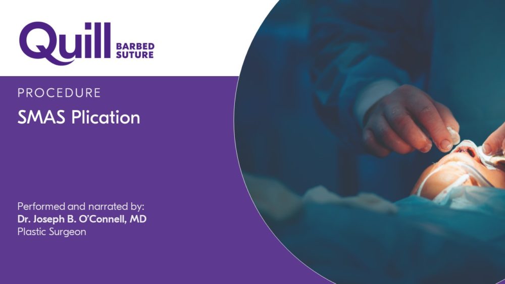 SMAS Plication - Corza Medical Global