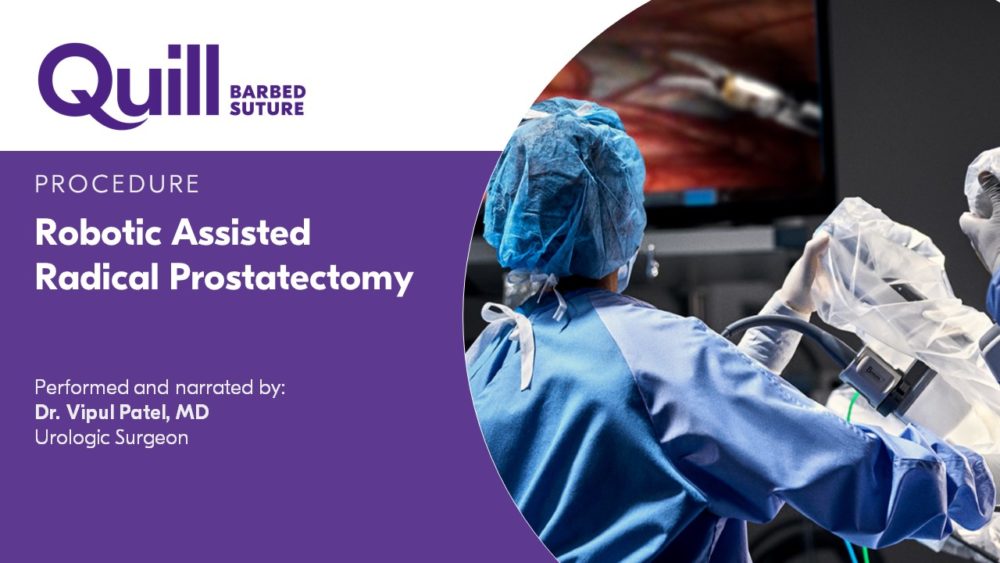 Robotic Assisted Radical Prostatectomy (RARP) using Quill™ Knotless ...