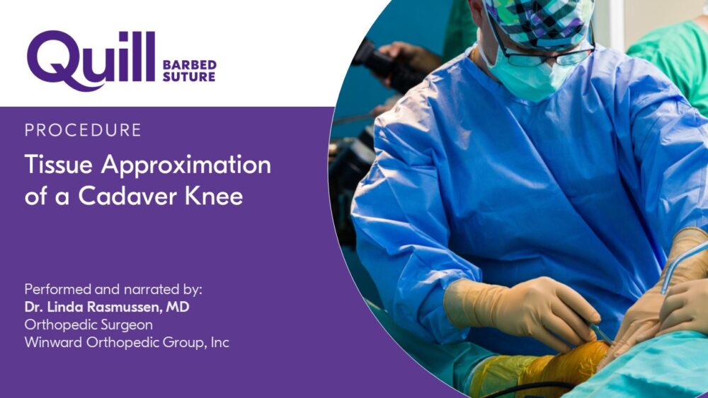 Tissue Approximation of a Cadaver Knee by Dr. Linda Rasmussen - Corza ...