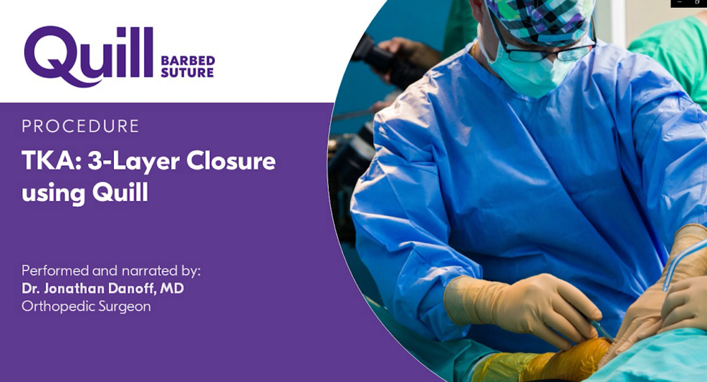 A Guide to Using Quill Barbed Suture in a TKA Wound Closure - Corza Medical