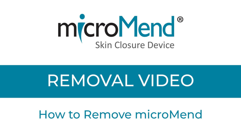 How to Remove microMend PRO - Corza Medical