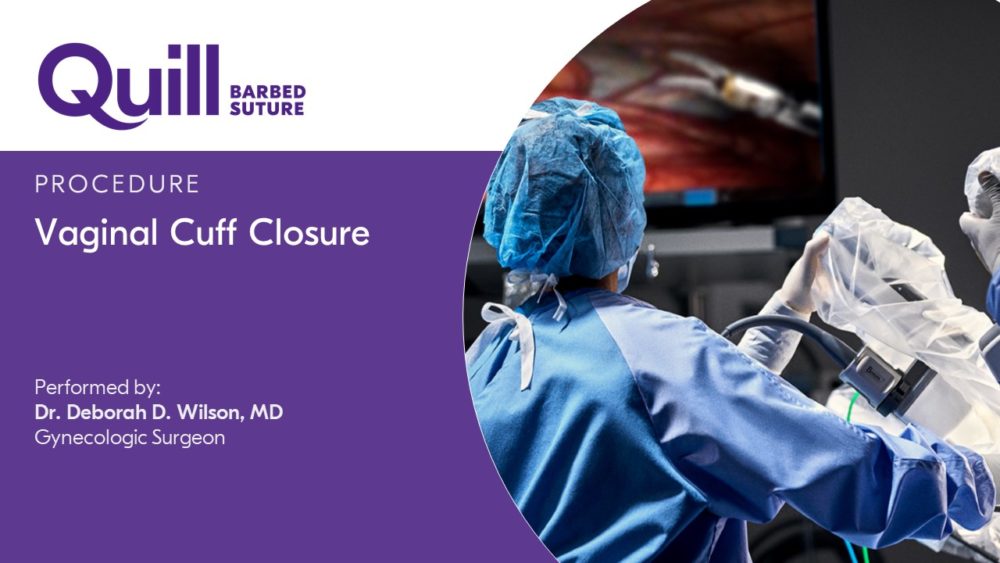 Vaginal Cuff Closure By Dr. Deborah Wilson - Corza Medical