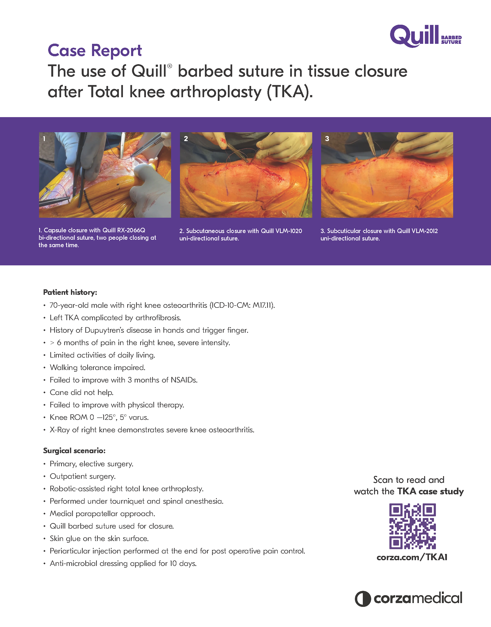 Case report: The use of Quill barbed suture in tissue closure after ...